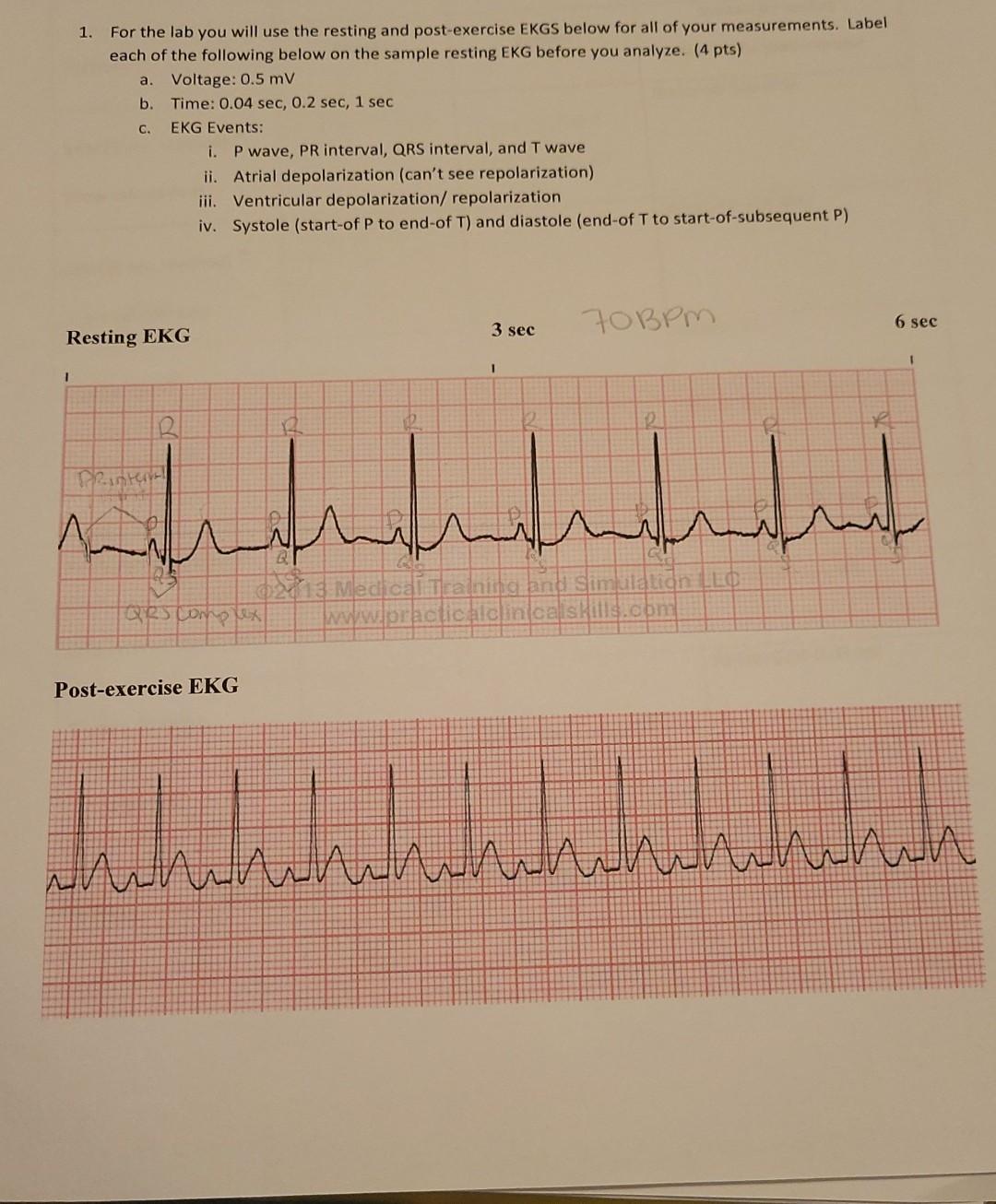 Solved 1. For the lab you will use the resting and | Chegg.com