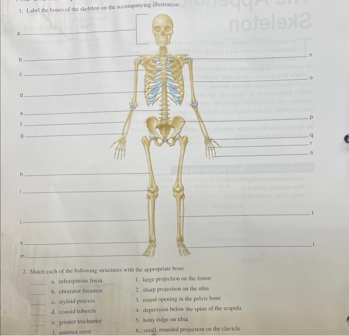 Solved 2. Identify the bones and bone markings in the | Chegg.com