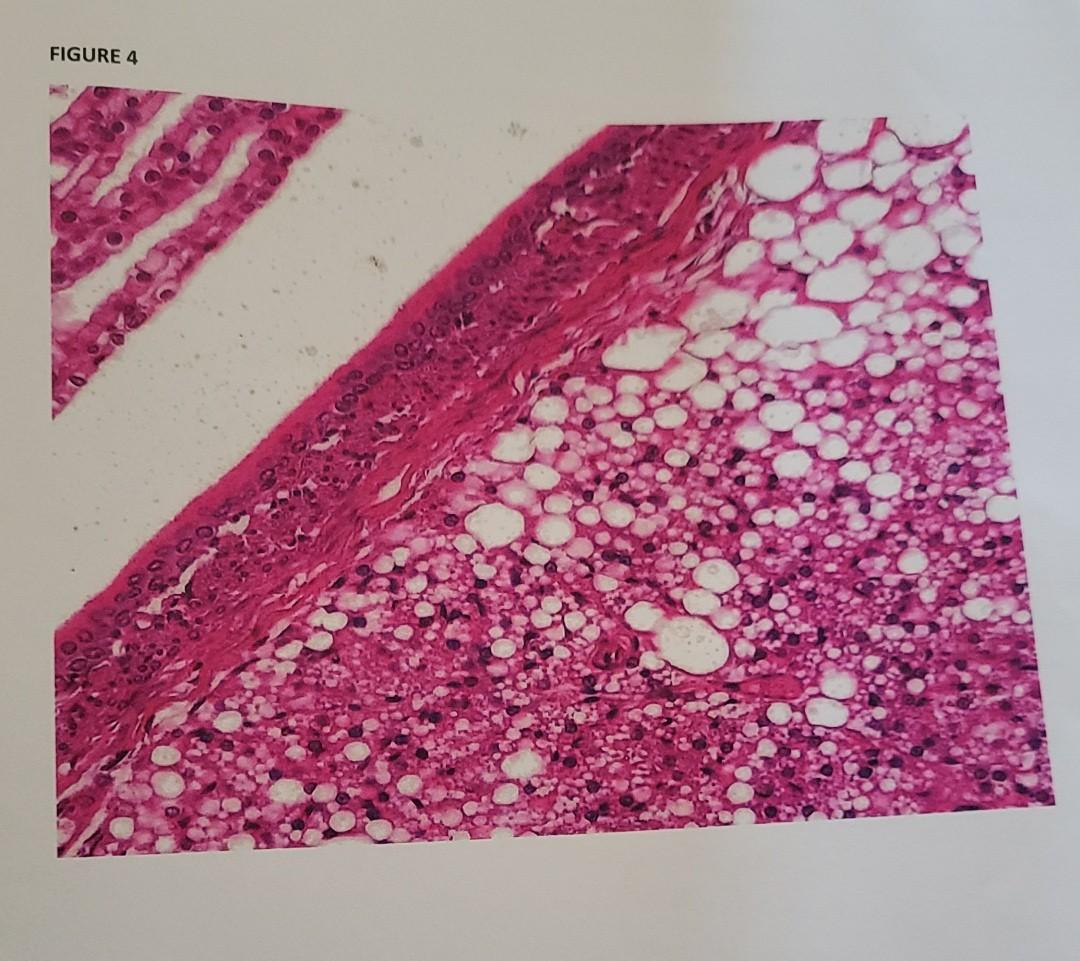 Assignment 2, Unit 1 1. Name the four basic tissue | Chegg.com