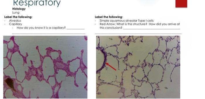 Solved Histology Lung Label the following: Label the | Chegg.com