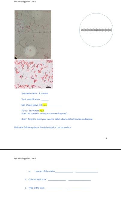 Solved Post Lab 6 (Endospore Staining) Record your | Chegg.com