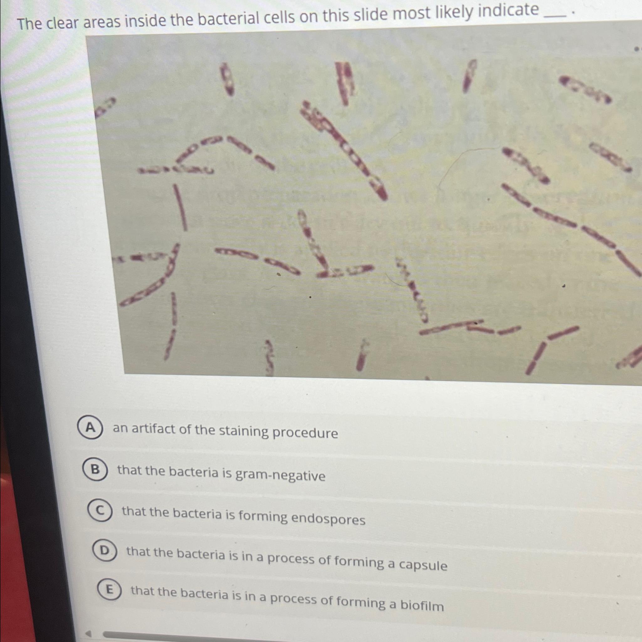 Solved The clear areas inside the bacterial cells on this | Chegg.com
