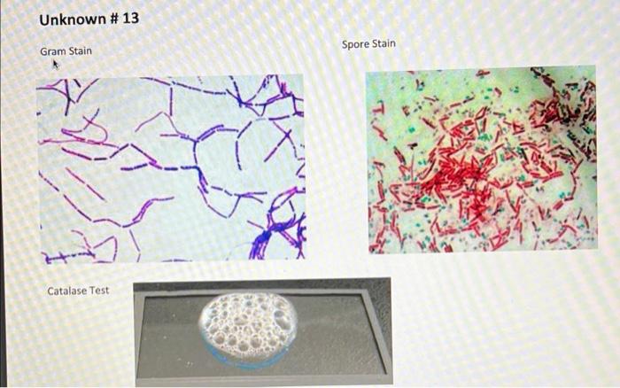 Solved Unknown # 13 Gram Stain Spore Stain Catalase Test | Chegg.com