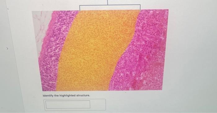 Solved Name the highlighted cells. Identify the highlighted | Chegg.com