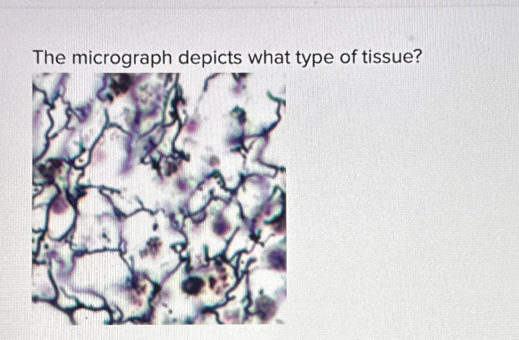 Solved The micrograph depicts what type of tissue? | Chegg.com