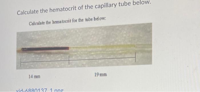 Solved Calculate the hematocrit of the capillary tube below. | Chegg.com