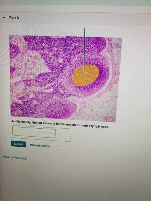 Solved Part A Identify the highlighted structure in this | Chegg.com