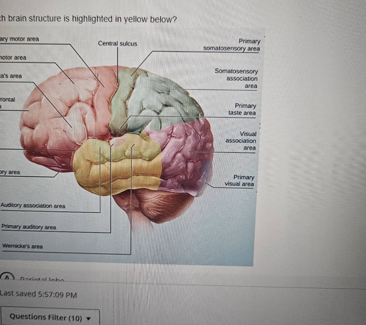 Solved brain structure is highlighted in yellow below?Last | Chegg.com