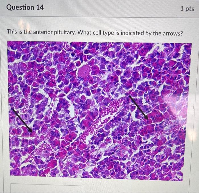 Solved Question 14 1 pts This is the anterior pituitary. | Chegg.com