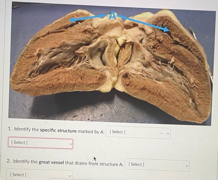 Solved 1. Identify the specific structure marked by A : 2. | Chegg.com