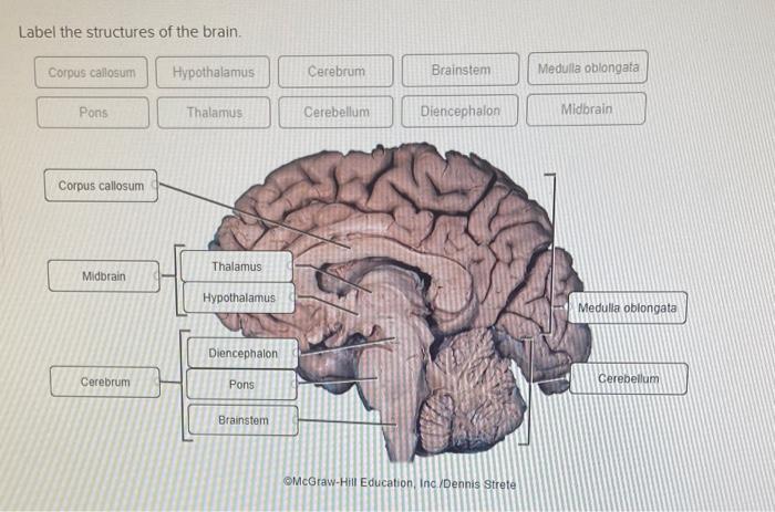 Solved Label the structures of the brain. Corpus callosum | Chegg.com