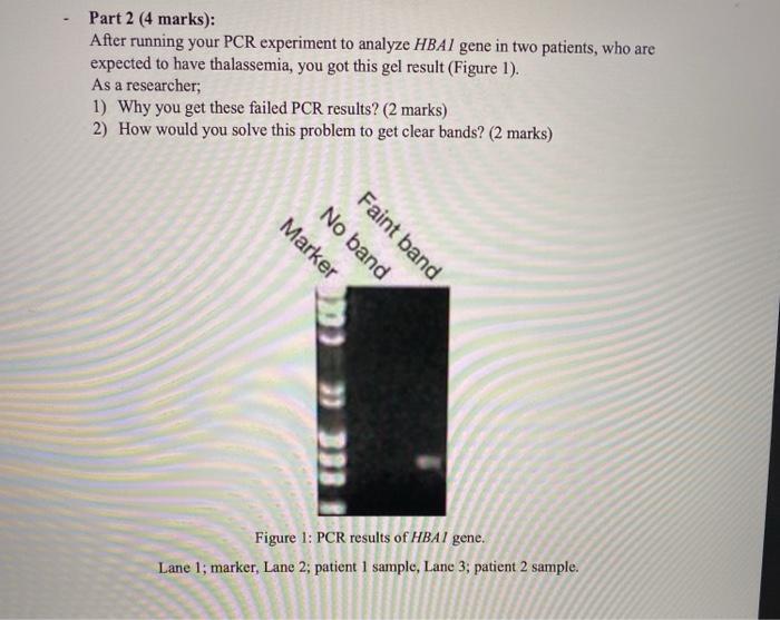 Solved Part 2 (4 marks): After running your PCR experiment | Chegg.com