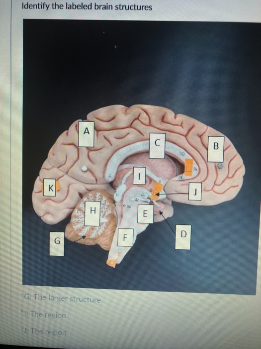 Solved Identify the labeled brain structures A C B B K J H E | Chegg.com