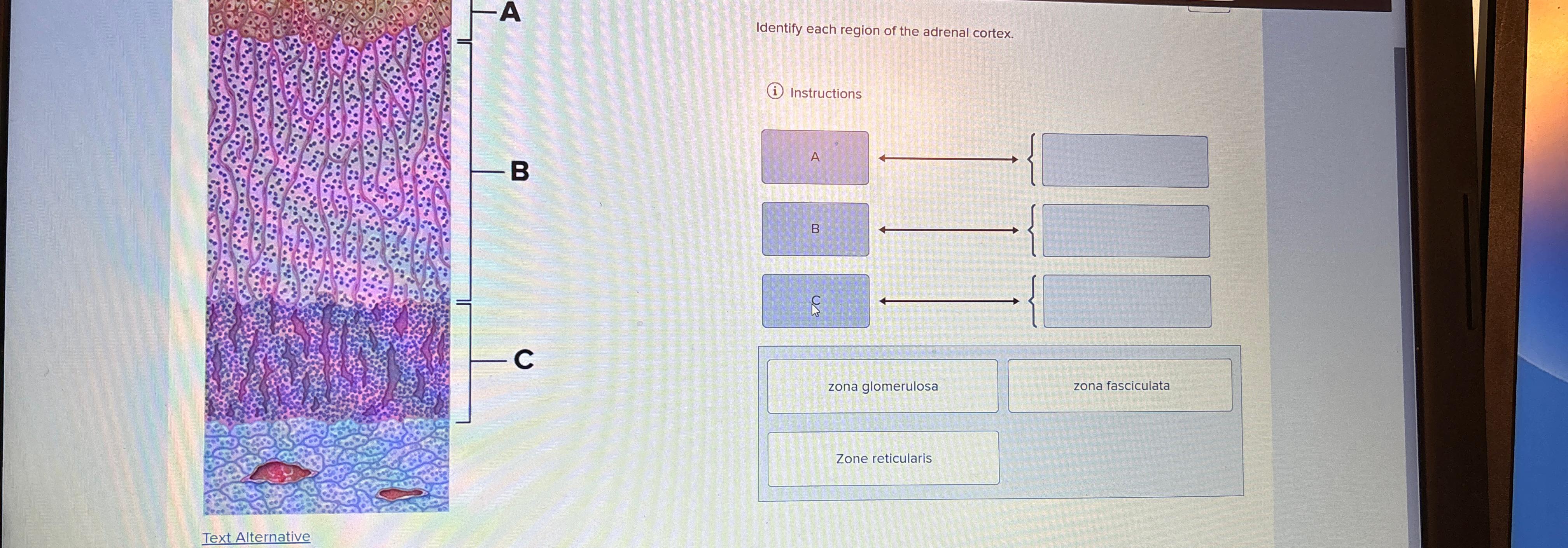 Solved Identify each region of the adrenal cortex.(i) | Chegg.com Solved Identify each region of the adrenal cortex.(i) | Chegg.com
