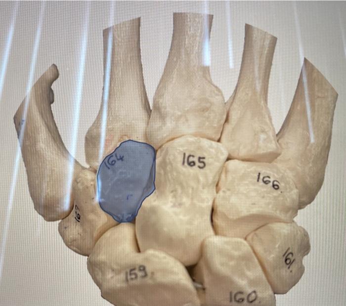 Solved Lunate Capitate Scaphoid Trapezoid Trapezium | Chegg.com
