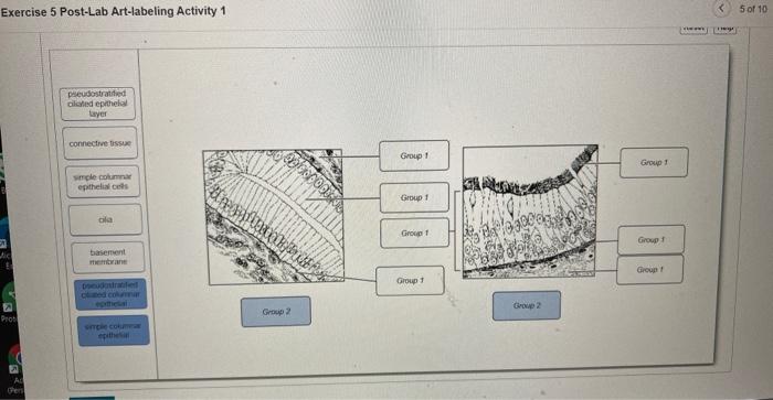 Solved Exercise 5 Post-Lab Art-labeling Activity 1 | Chegg.com