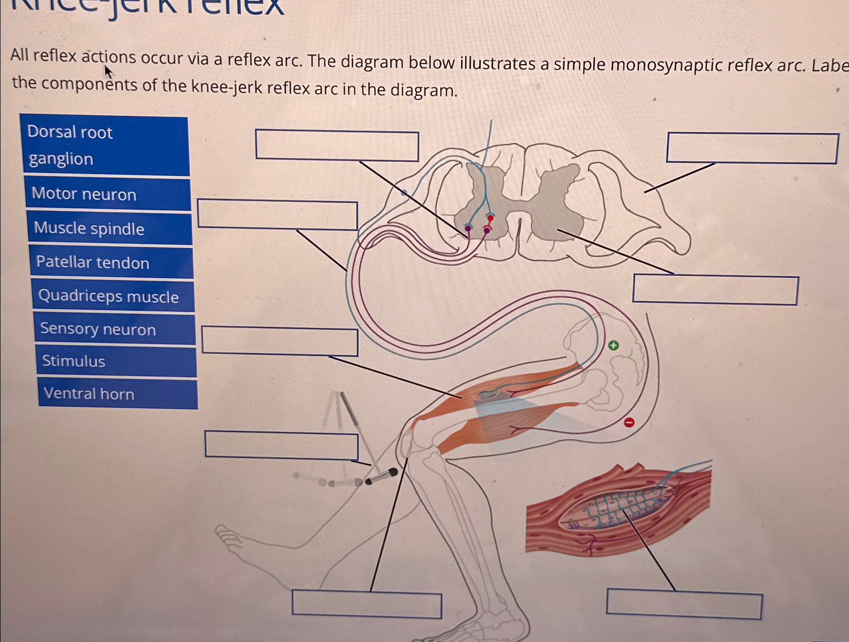 Solved All reflex actions occur via a reflex arc. The | Chegg.com