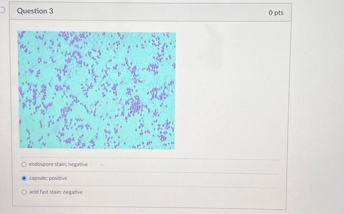 Solved endospore stain; negative capsule; positive acid | Chegg.com