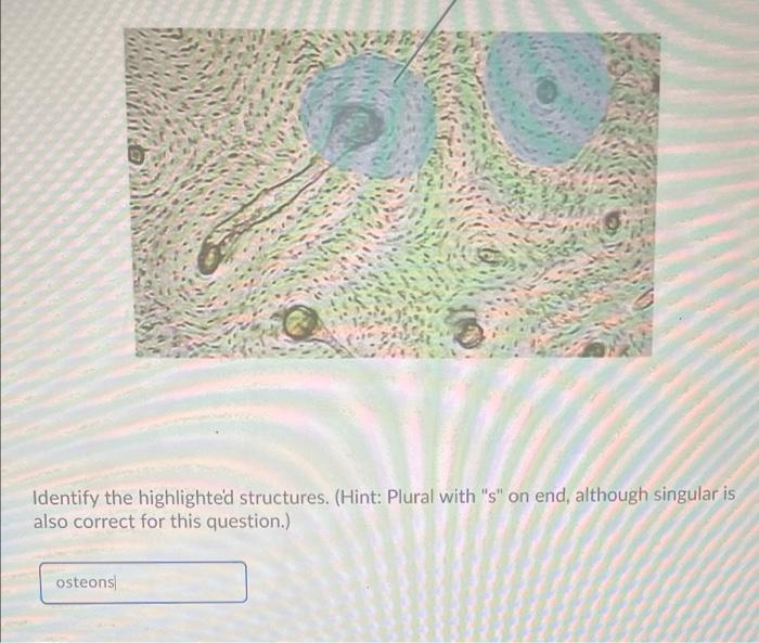 Solved Identify the highlighted structure. (Hint: it is a | Chegg.com