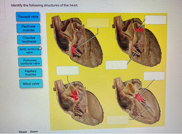 Solved Identify the following structures of the heart. | Chegg.com