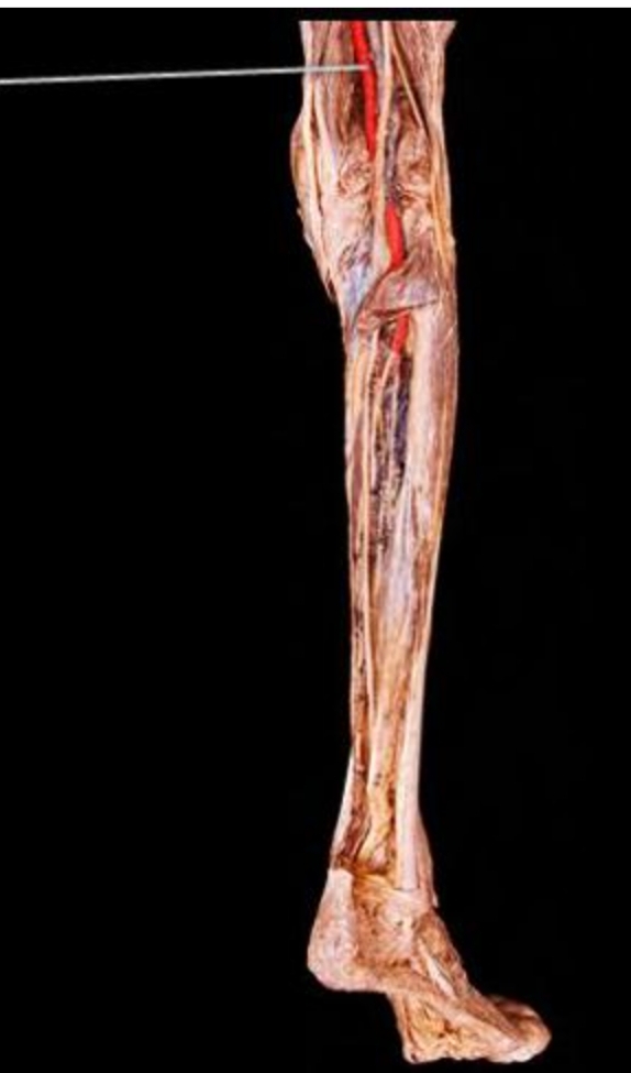 Solved name the highlighted artery above the knee | Chegg.com