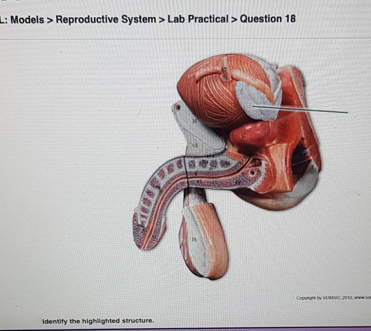 : Models > Reproductive System > Lab Practical > | Chegg.com
