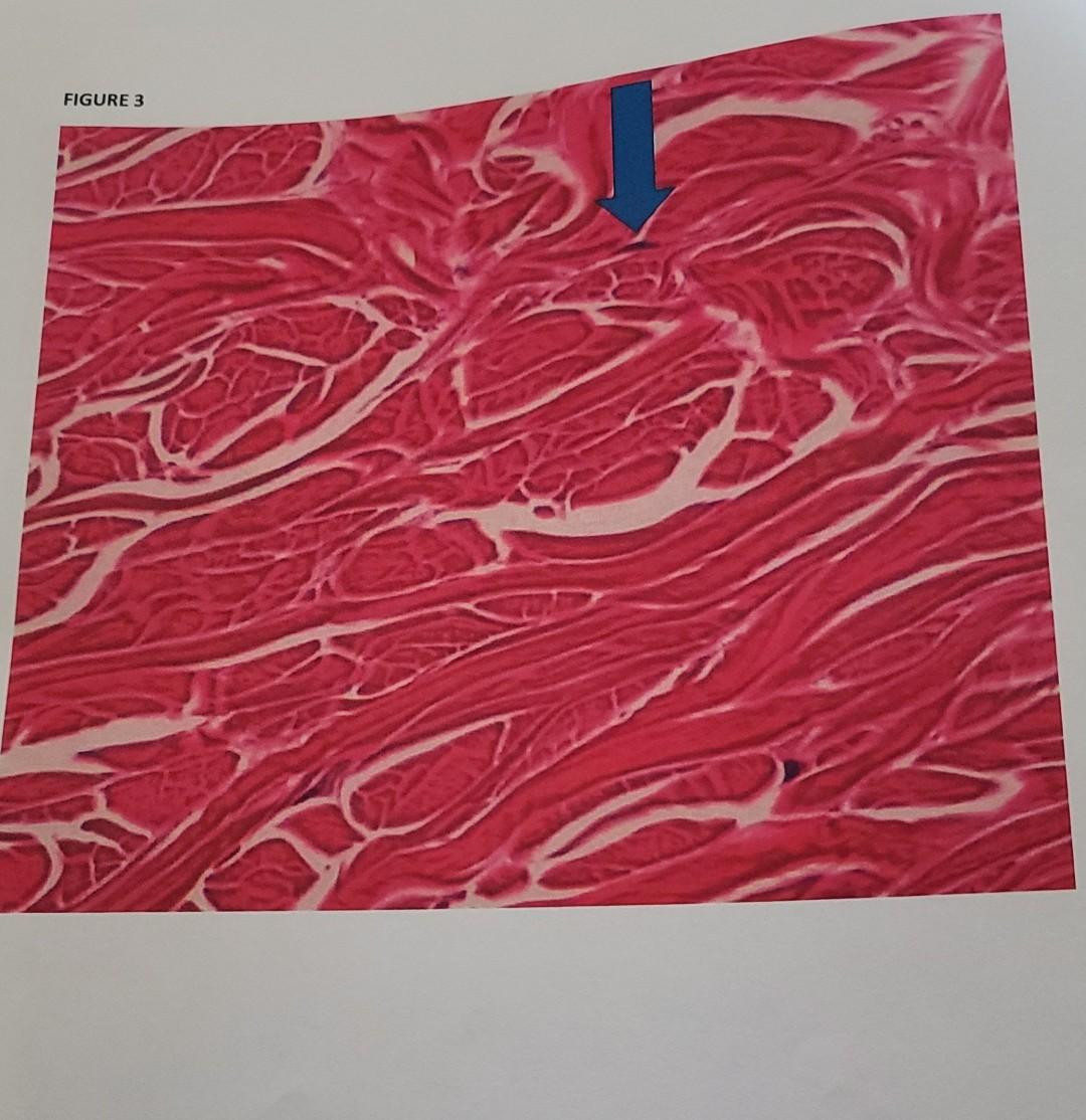 Assignment 2, Unit 1 1. Name the four basic tissue | Chegg.com