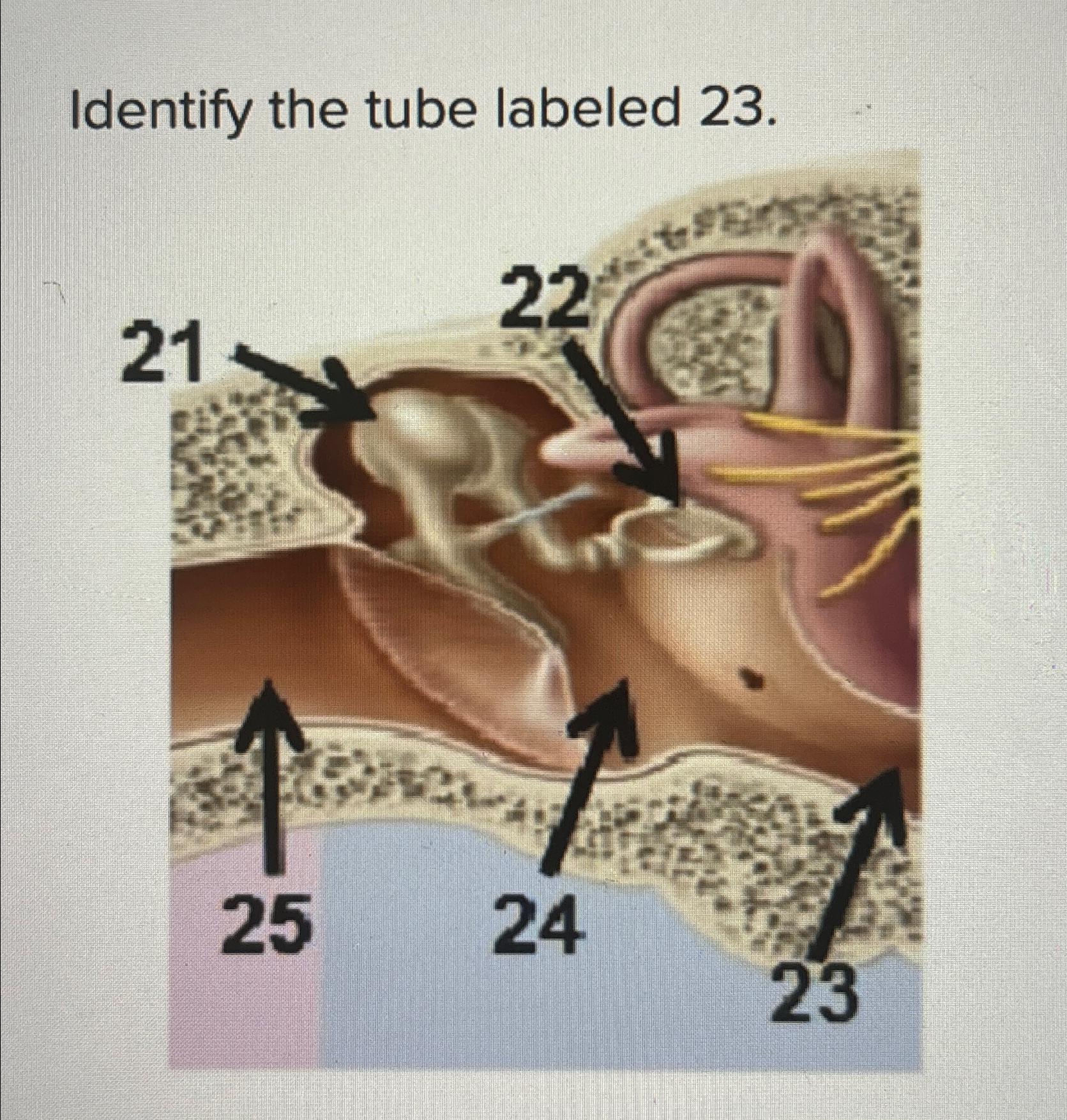 Solved Identify the tube labeled 23 . | Chegg.com