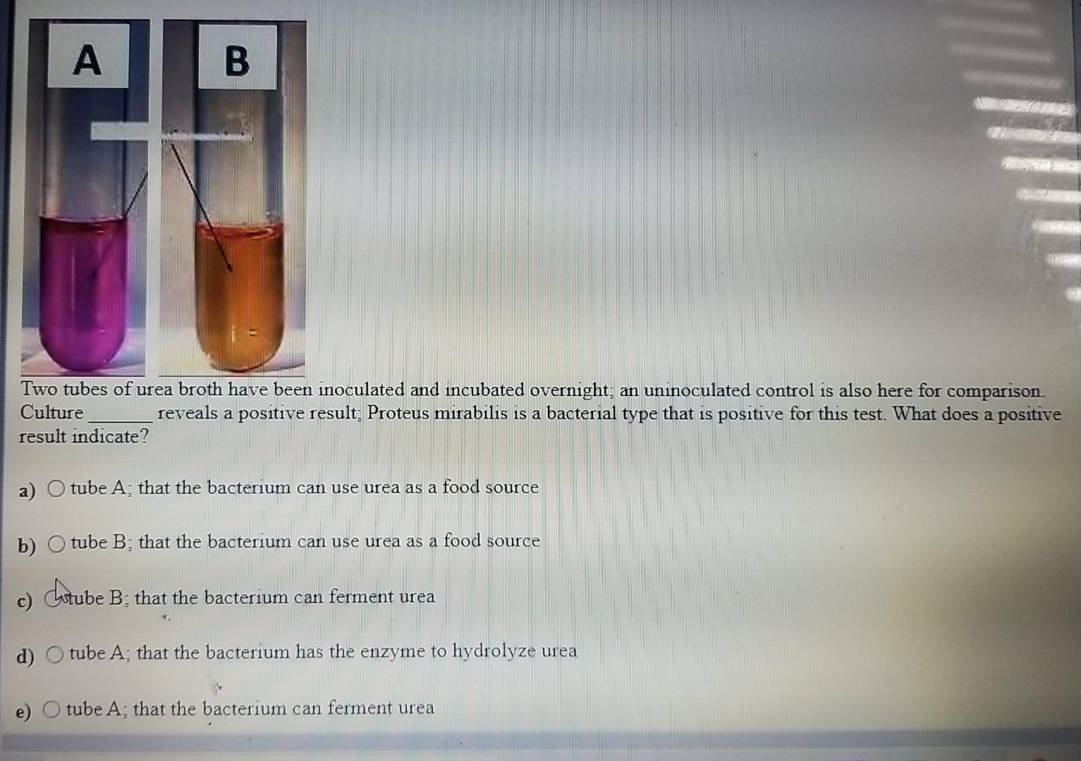 Solved А B Two tubes of urea broth have been inoculated and | Chegg.com