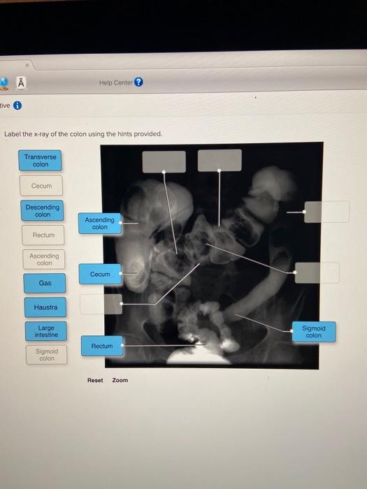 Ā Help Center Live 6 Label The X Ray Of The Colon