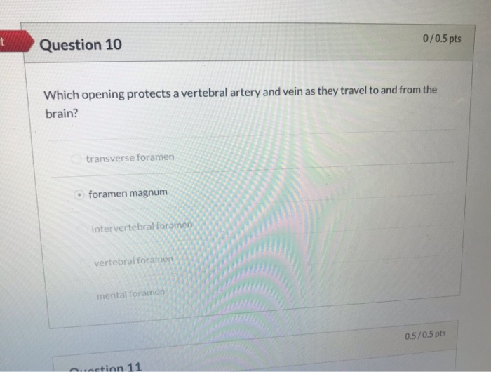 Solved Question 10 0/0.5 pts Which opening protects a | Chegg.com Solved Question 10 0/0.5 pts Which opening protects a | Chegg.com