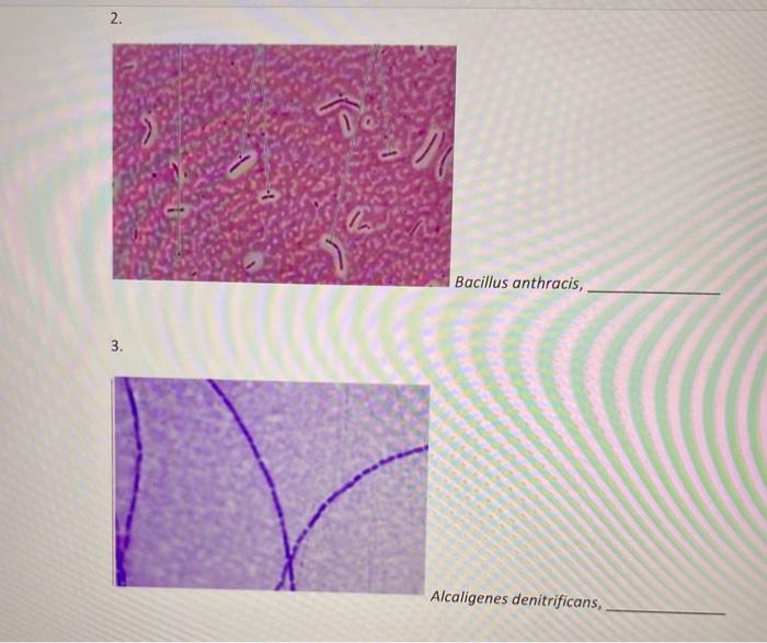 Solved B. Observe the following micrographs and determine if | Chegg.com Solved B. Observe the following micrographs and determine if | Chegg.com