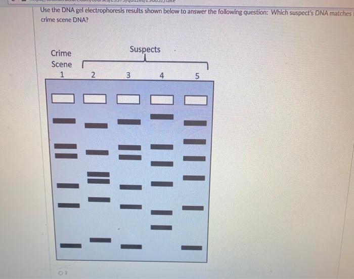 Electrophoresis Results