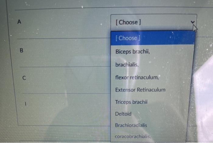 Solved Match the name of the upper extremity with the lables | Chegg.com