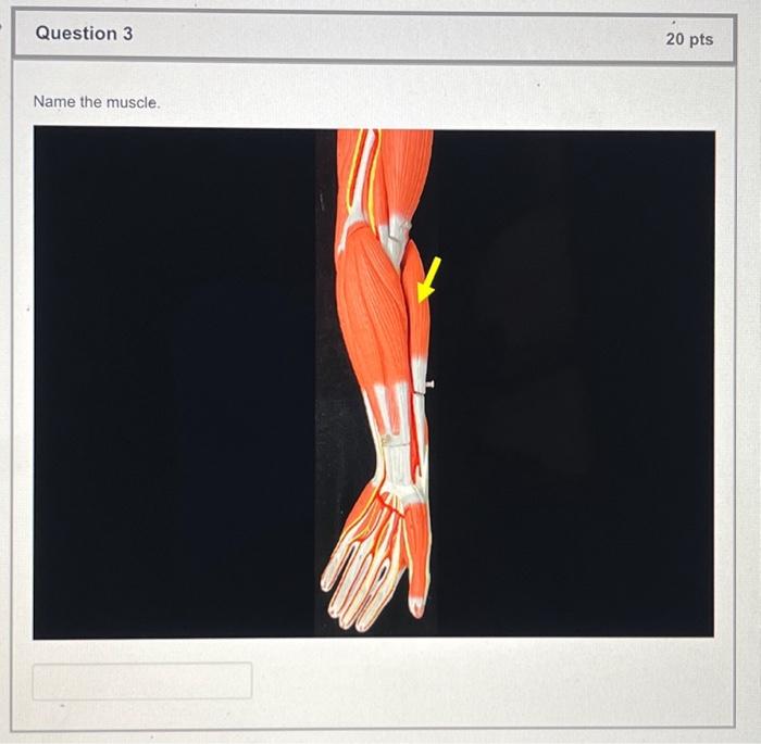 Solved Name the muscle. | Chegg.com