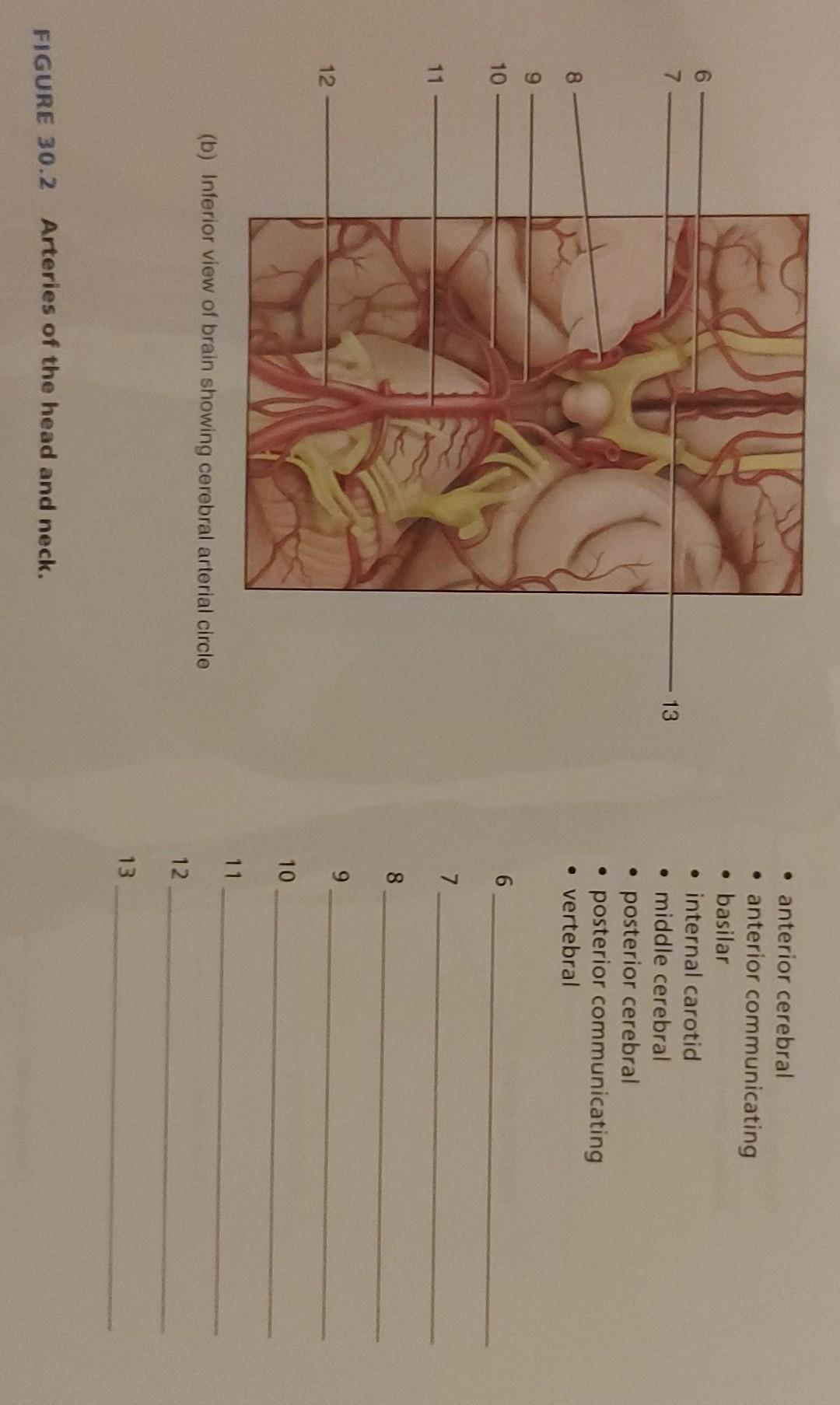 Solved - brachiocephalic trunk - common carotid - external | Chegg.com