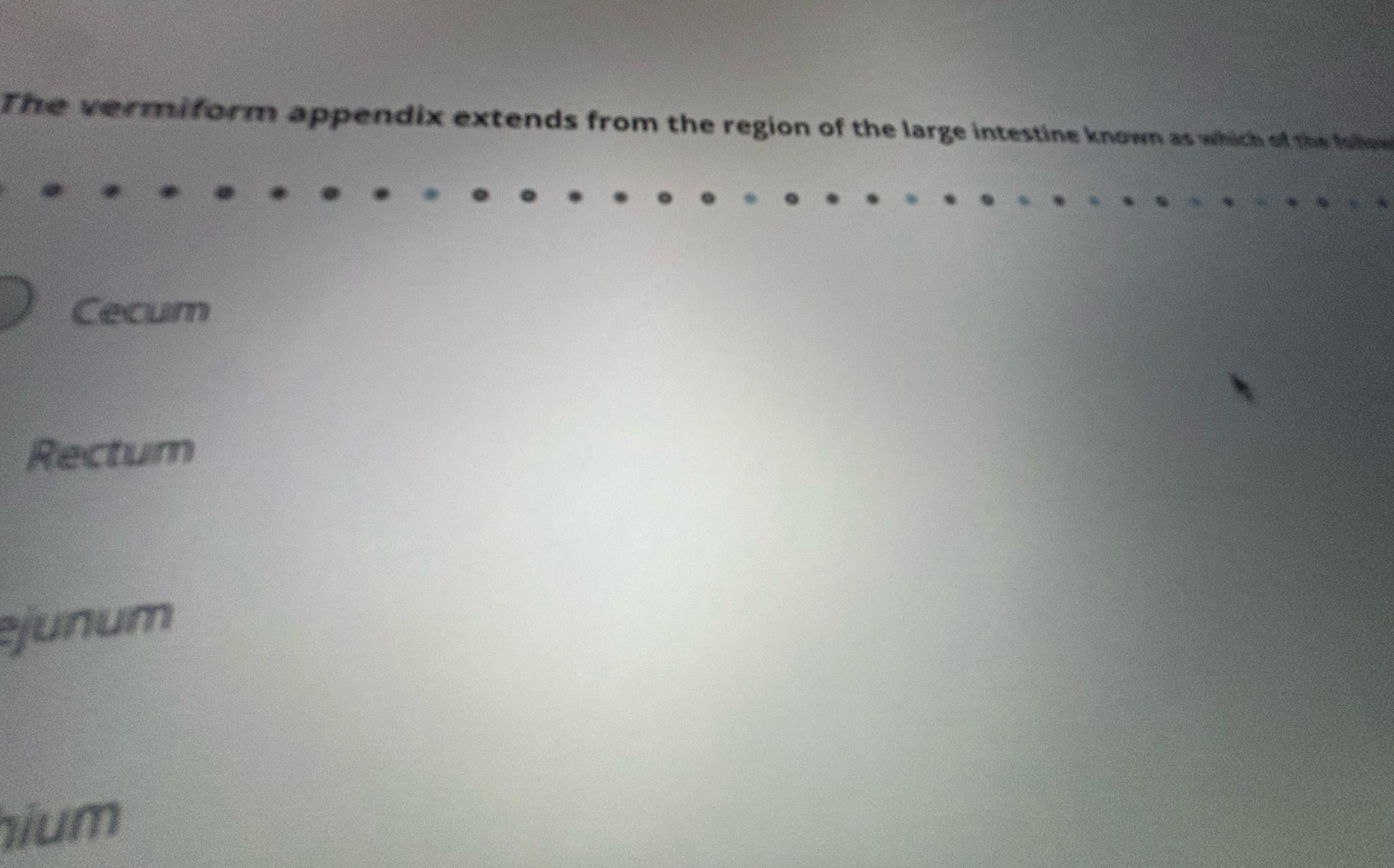 Solved The vermiform appendix extends from the region of the | Chegg.com