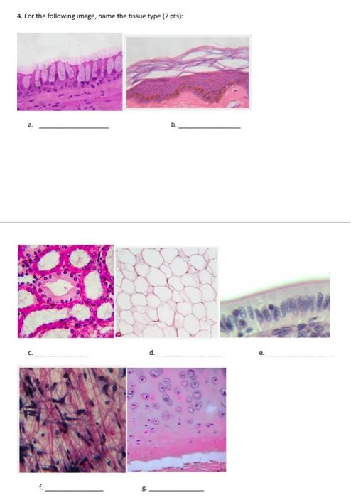 Solved 4. For the following image, name the tissue type ( | Chegg.com