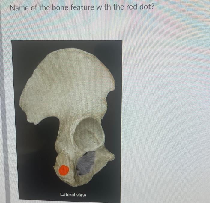 Solved Name of the bone feature with the red dot? | Chegg.com