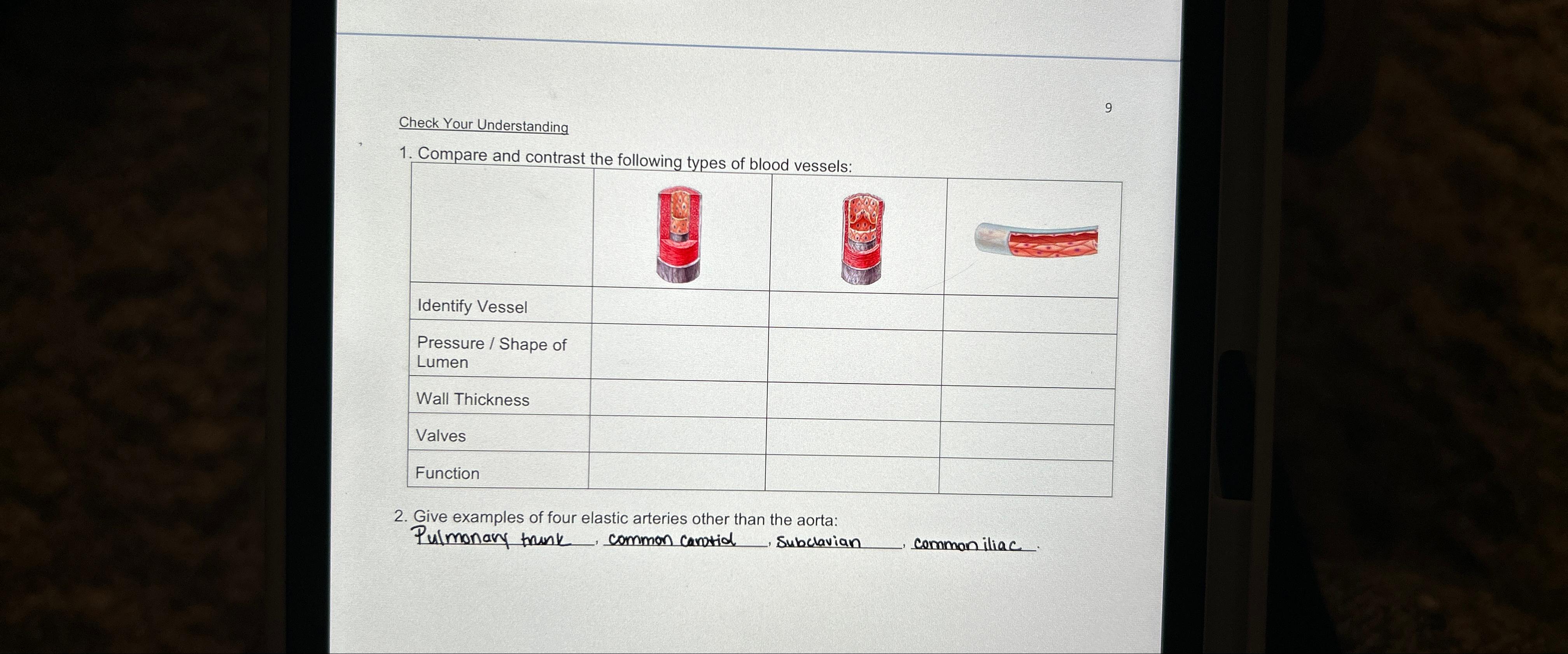 Solved Check Your Understanding9Compare and contrast the | Chegg.com