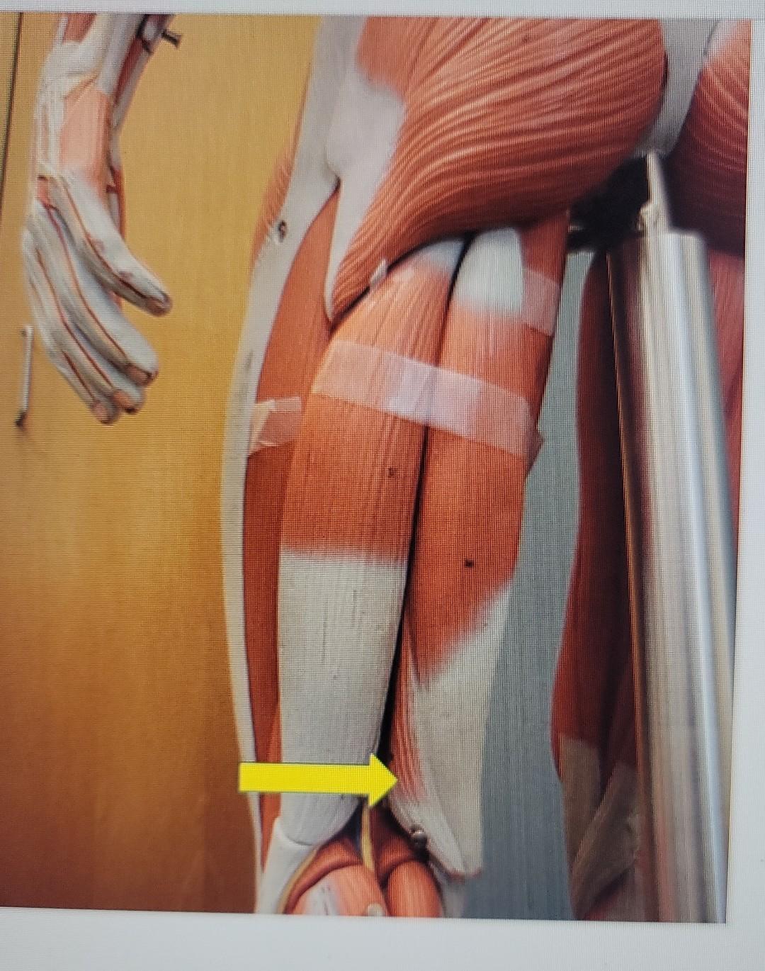 Solved Identify the muscle indicated by the arrow. | Chegg.com