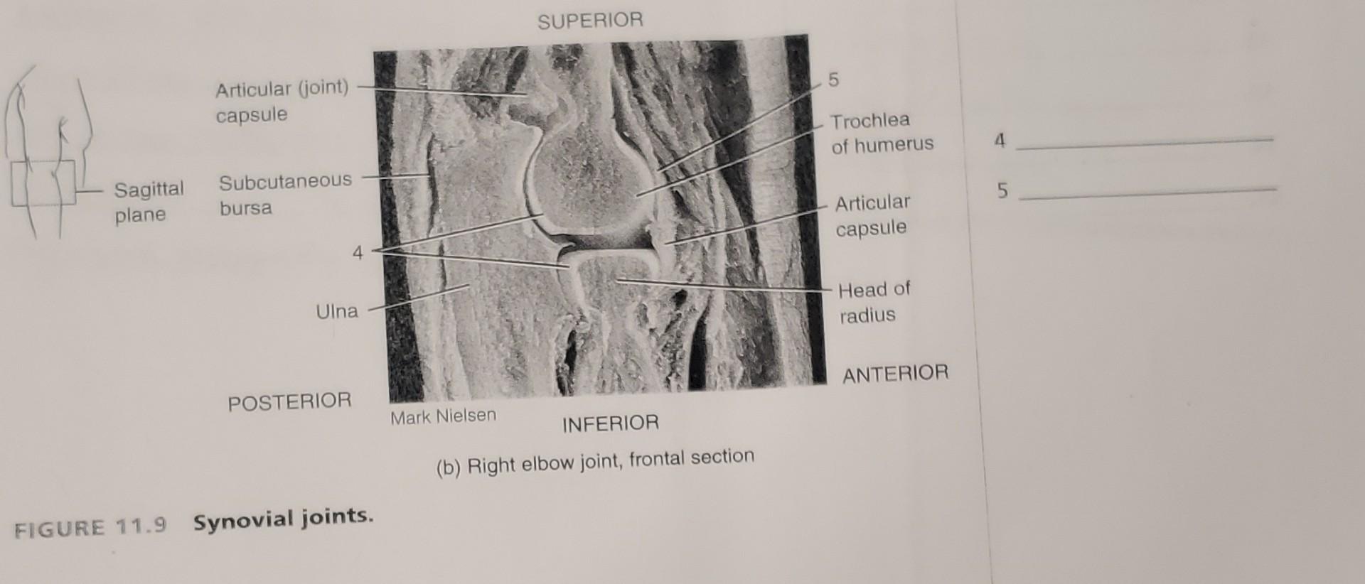 Solved 4 5 (b) Right elbow joint, frontal section FIGURE | Chegg.com