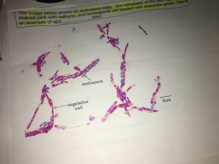 Solved The image below shows an endospore stain - the | Chegg.com