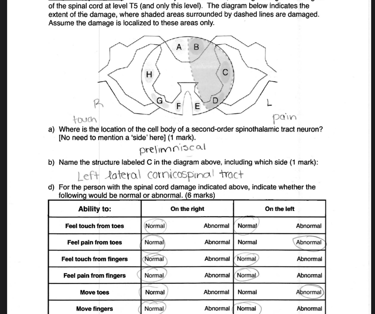 Solved of the spinal cord at level T5 (and only this level). | Chegg.com