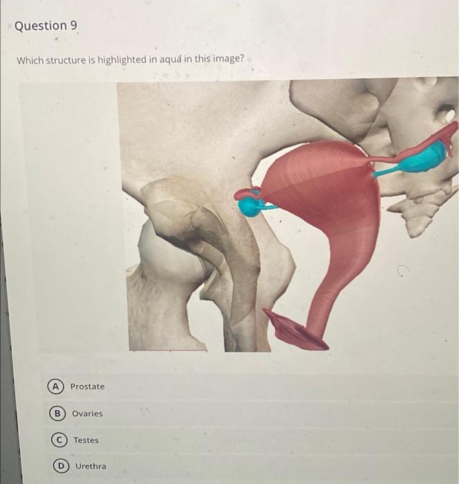 Solved Which structure is highlighted in aqua in this image? | Chegg.com