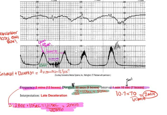 how to calculate frequency and duration for FHR? | Chegg.com