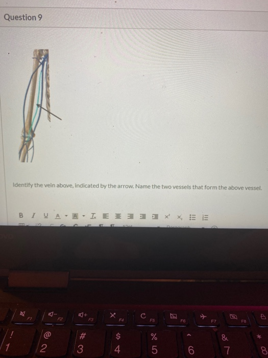 Solved Question 9 Identify the vein above, indicated by the | Chegg.com