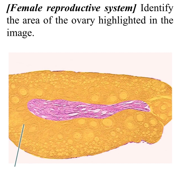 Solved [Female reproductive system] Identify the structure | Chegg.com