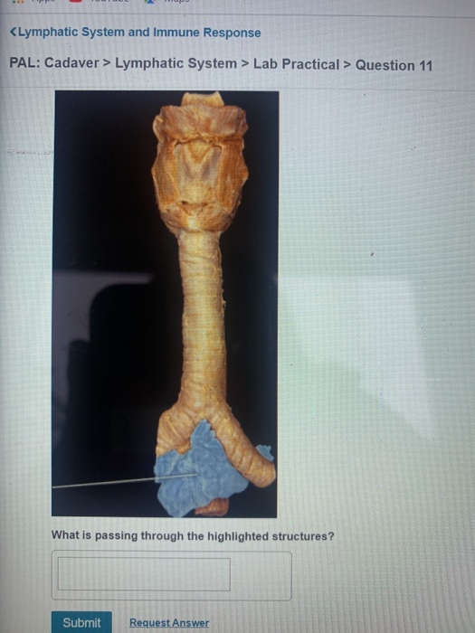 Solved Lymphatic System > Lab Practical > Question 11 What | Chegg.com
