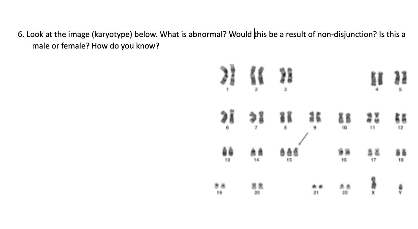 Solved Look at the image (karyotype) ﻿below. What is | Chegg.com